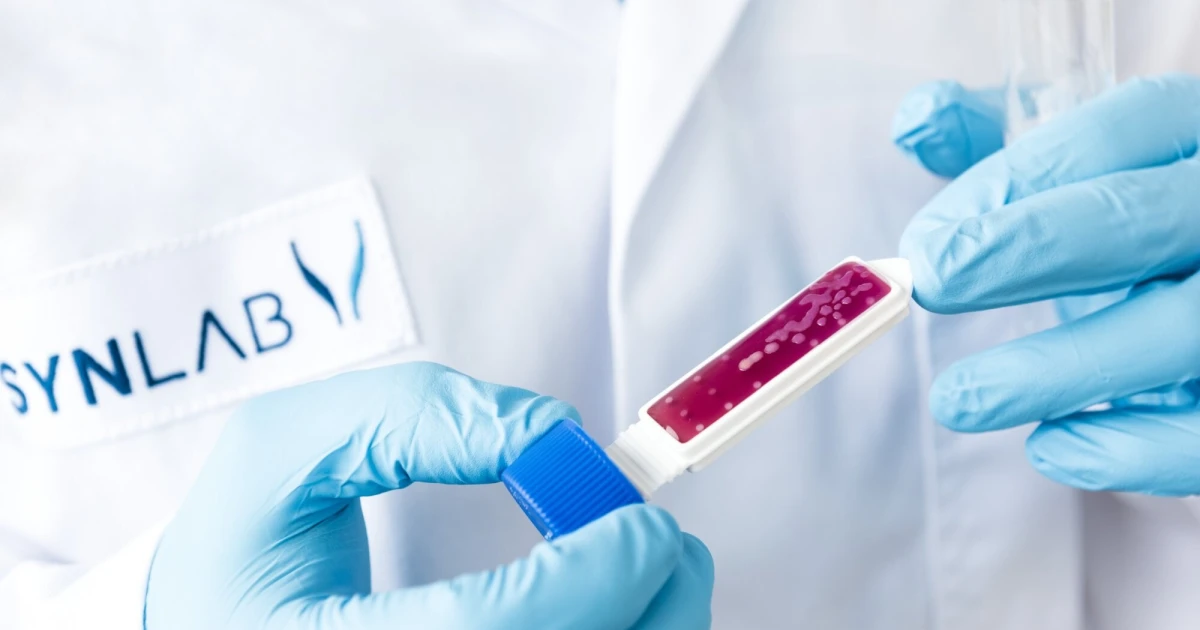 Kiderült, tényleg bekebelezi-e az állam a Synlab csoportot - Forbes.hu